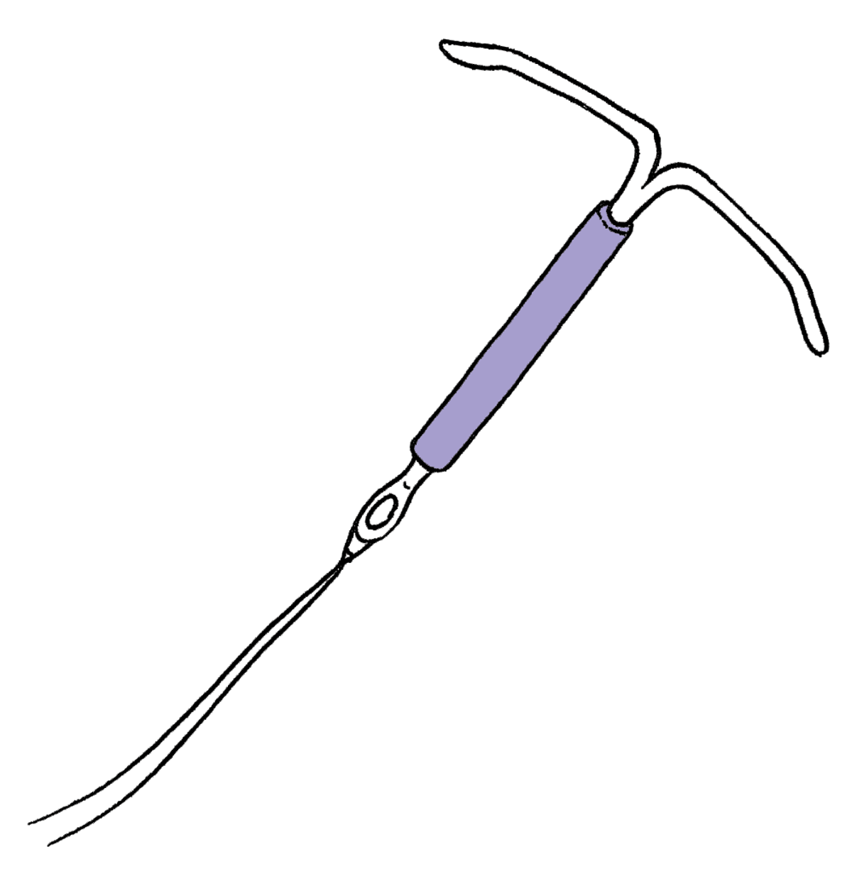 Intra uterine device | Get an IUD | Sexual Wellbeing Aotearoa