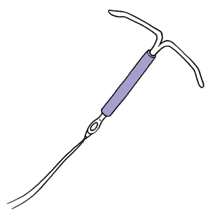 Intra uterine device | Get an IUD | Sexual Wellbeing Aotearoa