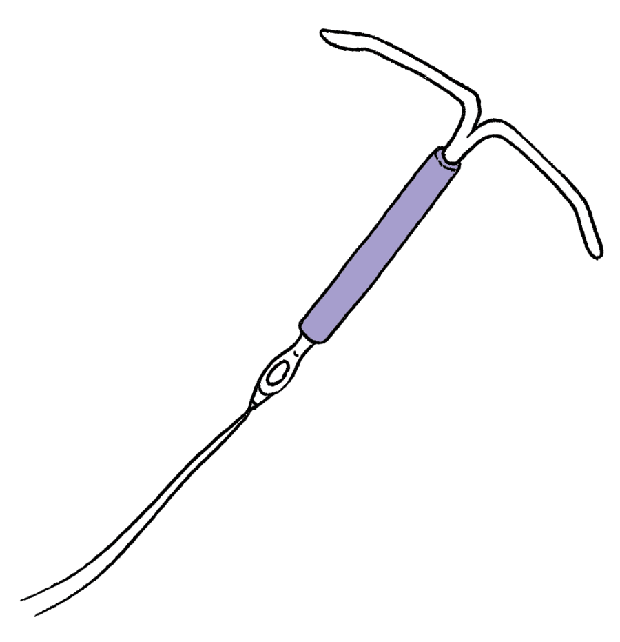 IUD | Intra Uterine Device FAQ | Sexual Wellbeing Aotearoa