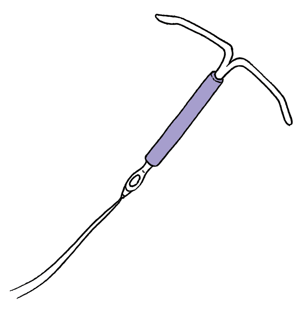Intra uterine device | Get an IUD | Sexual Wellbeing Aotearoa